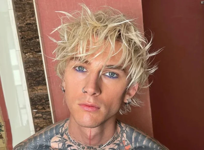 Machine Gun Kelly Mgk Plastic Surgery Comparison Photos
