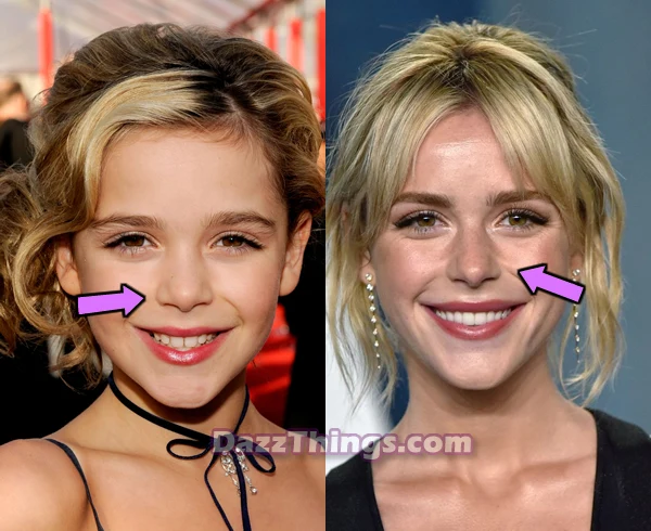 Kiernan Shipka Plastic Surgery Comparison Photos